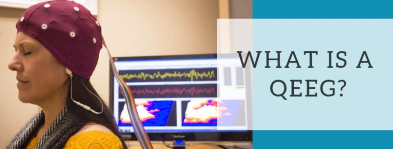 What is a QEEG? – Brain Therapy Clinic