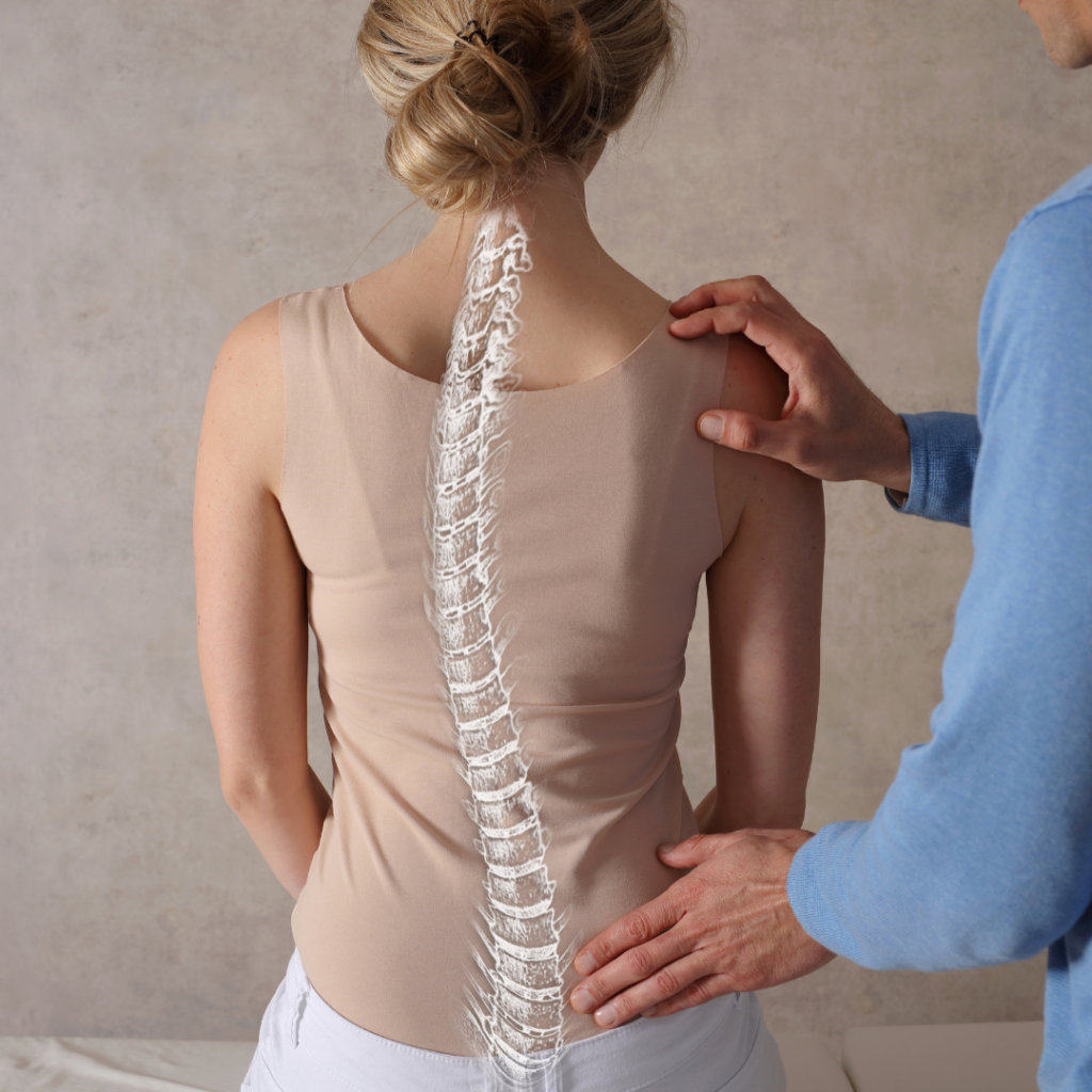 Scoliosis Posture – Brain Therapy Clinic